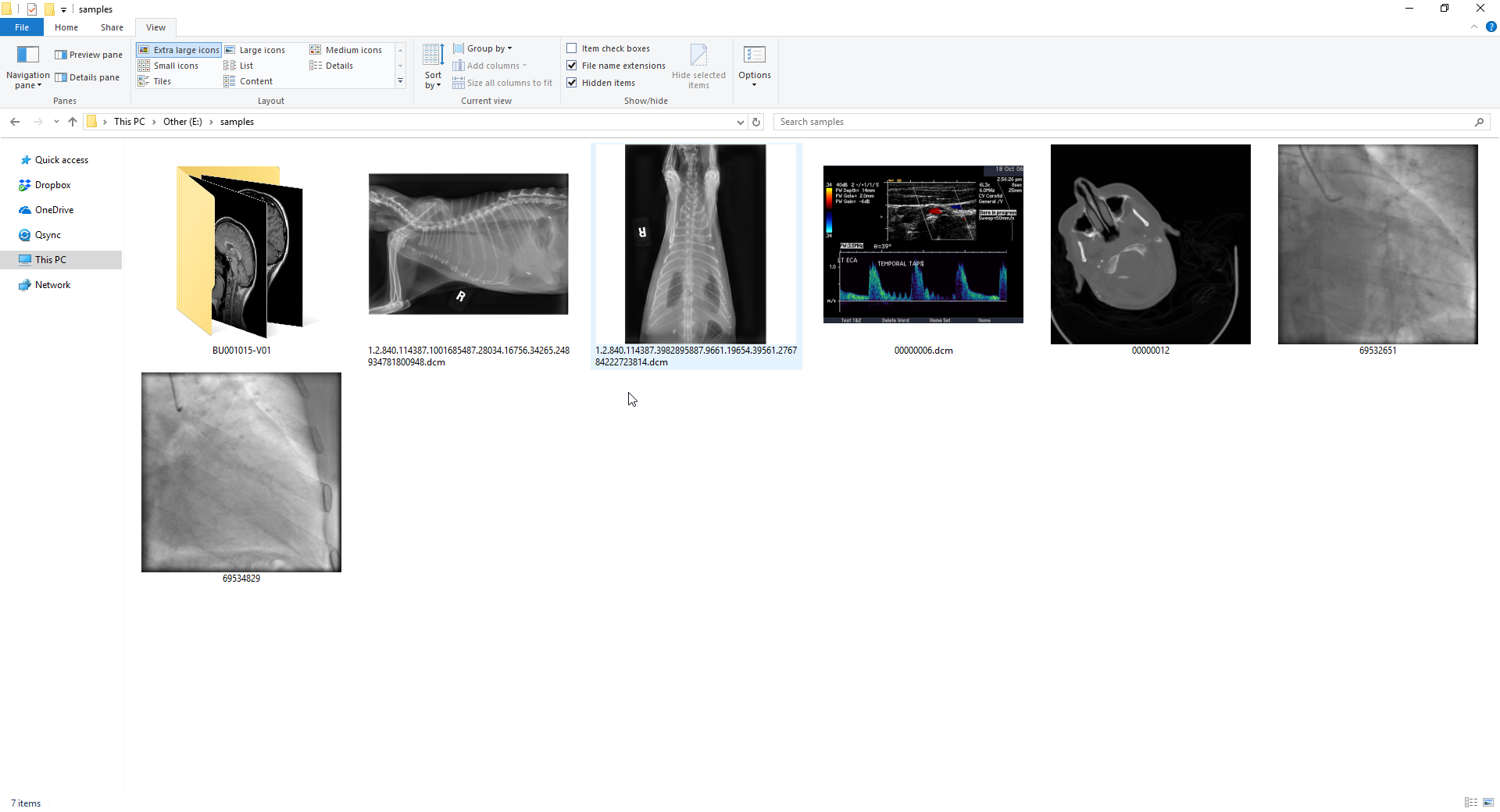 MicroDicom DICOM Viewer Download Free - 2025.3 | TechSpot