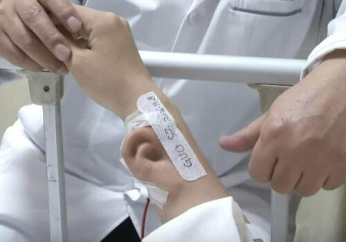 Man receives new ear grown on his forearm | TechSpot